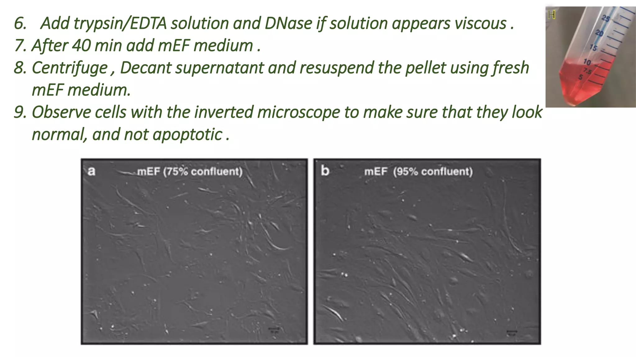 Hematopoietic development of human embryonic stem cells | PDF