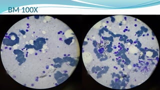 hematology slide discussion powerpoint pr | PPTX