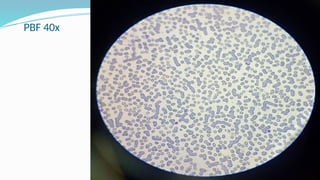 hematology slide discussion powerpoint pr | PPTX