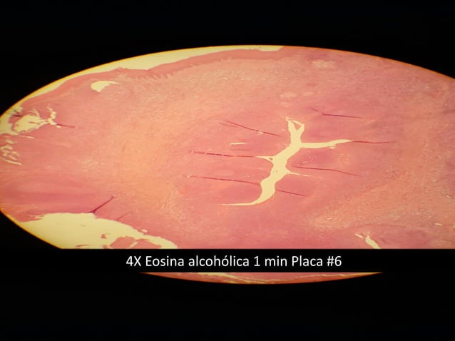 Tinción de Hematoxilina y Eosina | PDF