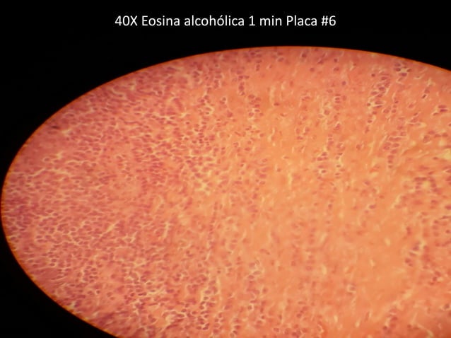 Tinción de Hematoxilina y Eosina | PDF