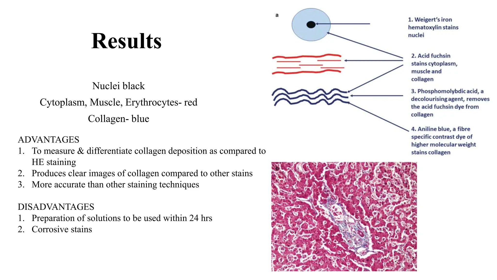 Histopathological staining techniques used in liver diseases | PPTX