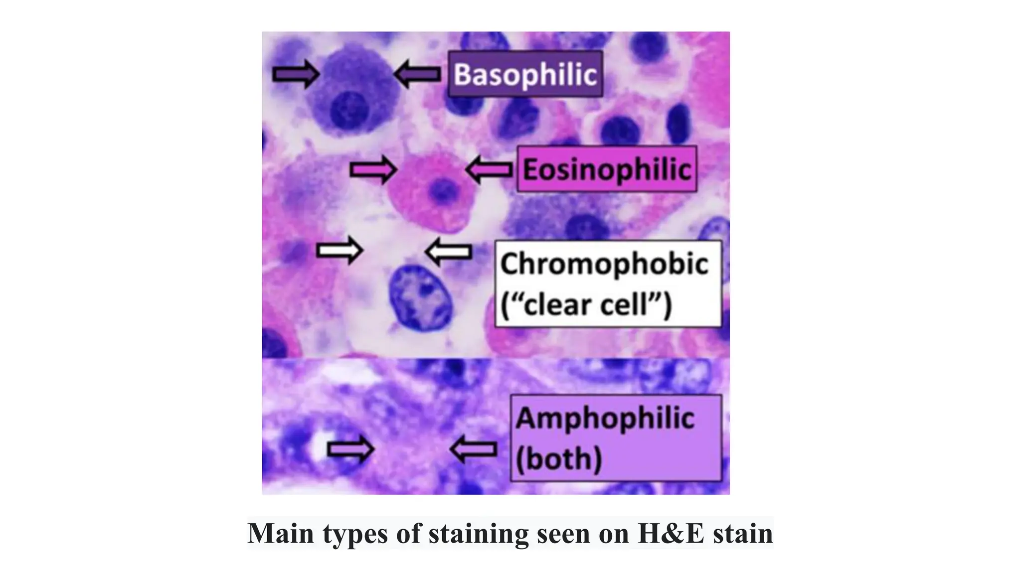 Histopathological staining techniques used in liver diseases | PPTX