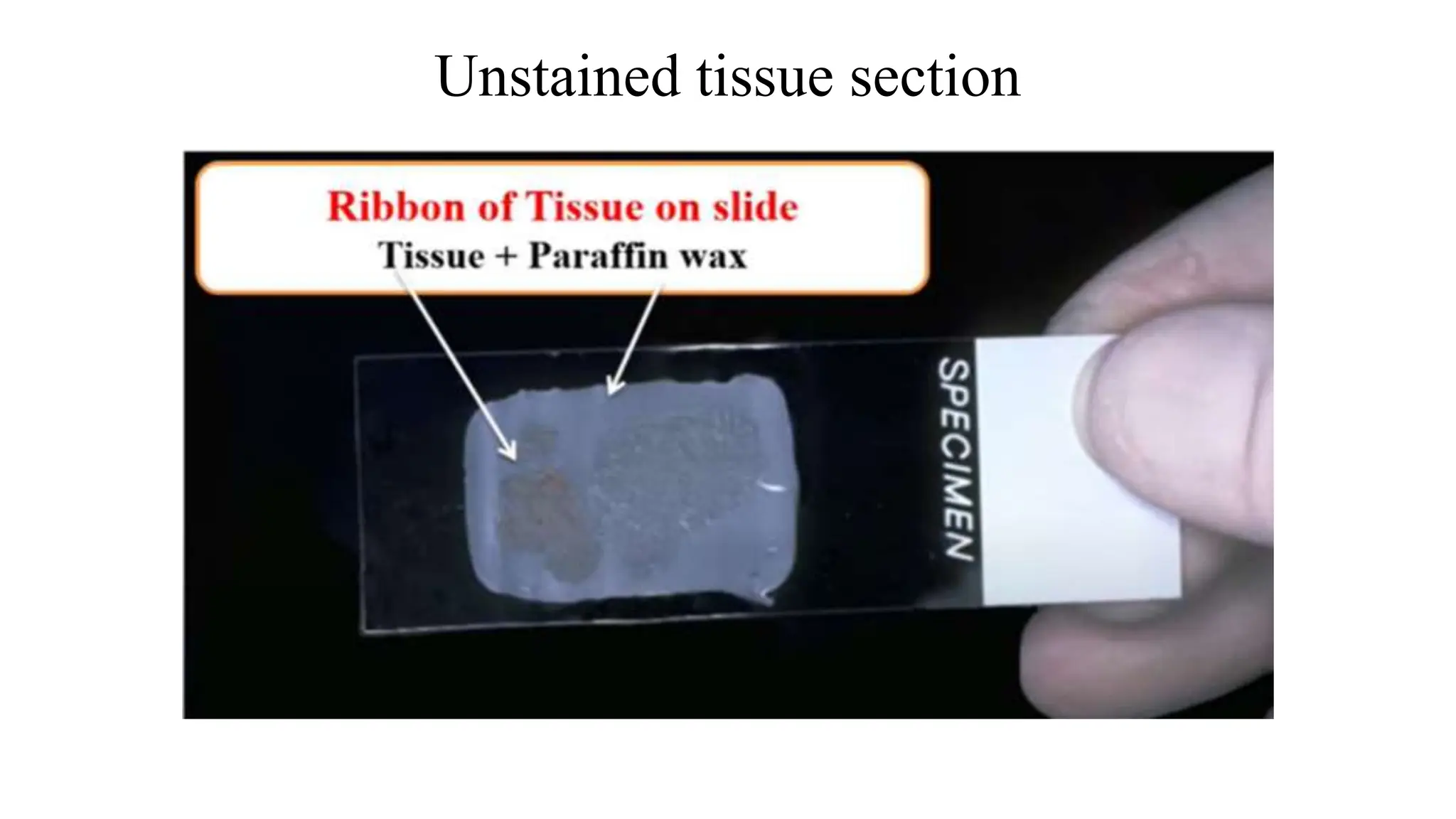 Histopathological staining techniques used in liver diseases | PPTX
