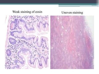 Hematoxylin and eosin staining | PPTX