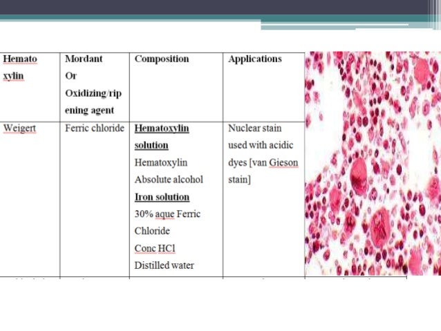 Hematoxylin and eosin staining