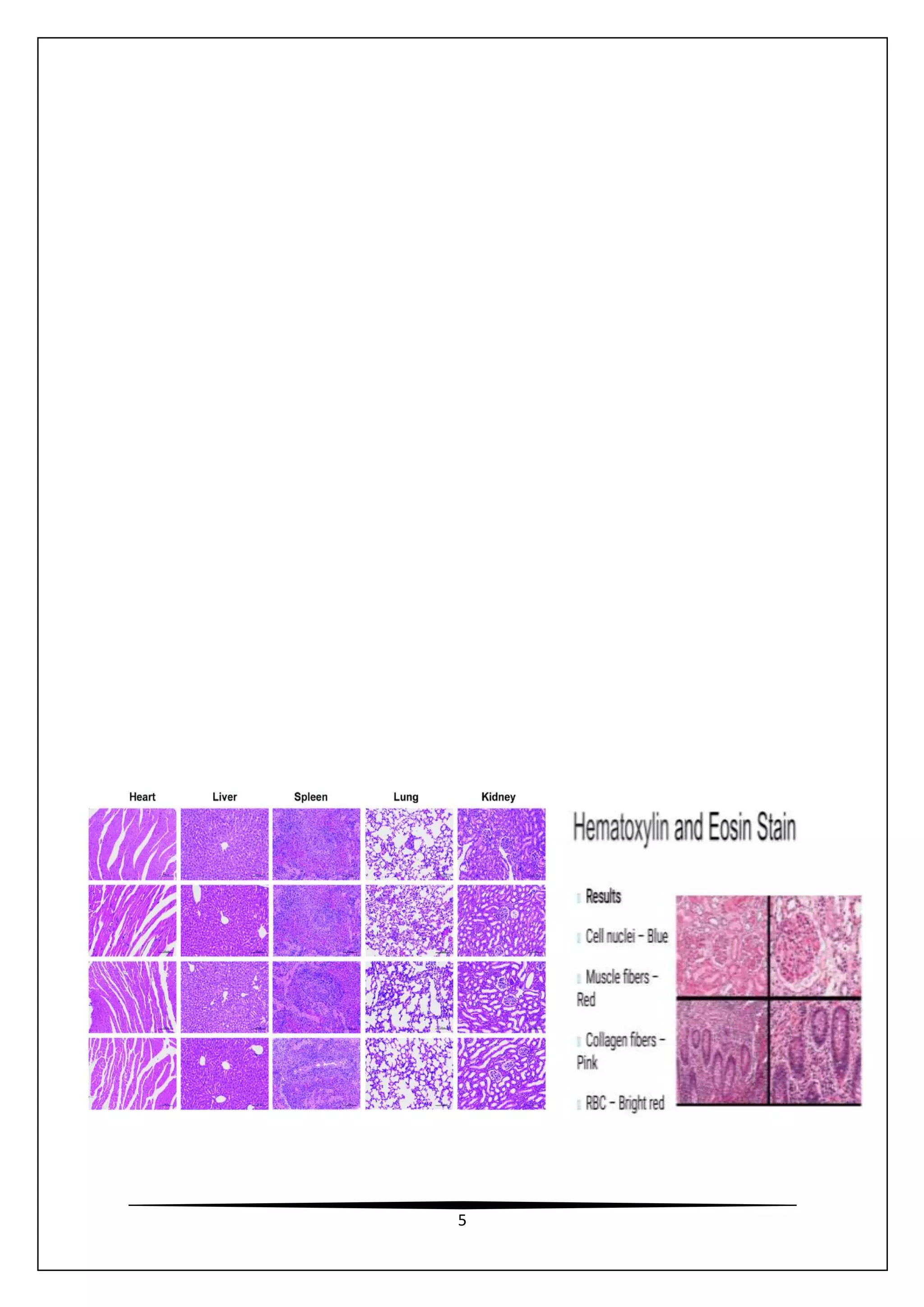 Hematoxylin & eosin stain | DOCX | Blood Disorders | Diseases and Conditions