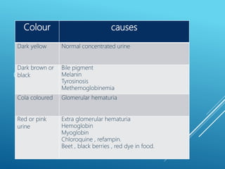 Hematuria in children | PPTX