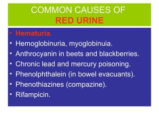 Hematuria | PPT