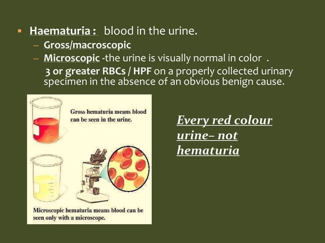 IMAGING IN HEMATURIA | PPTX
