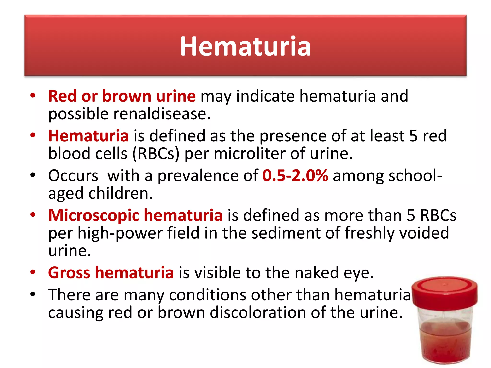 Red Urine and Hematuria in children | PPTX