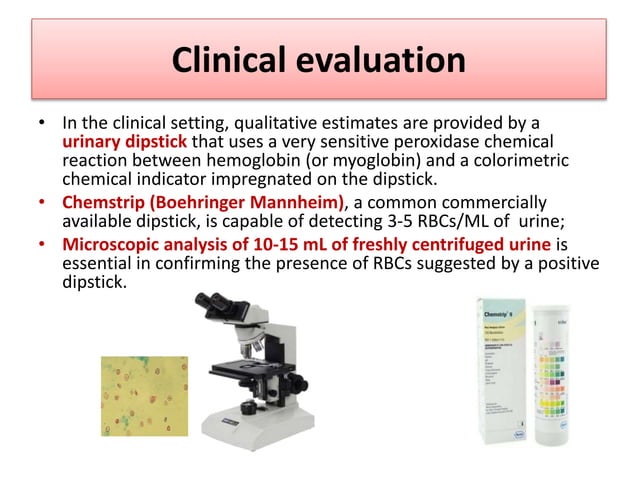 Red Urine and Hematuria in children | PPT