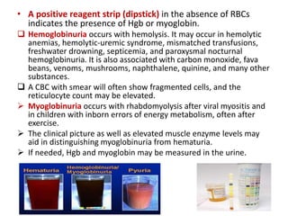 Hemoglobinuria Vs Myoglobinuria