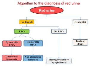 Hematuria | PPTX