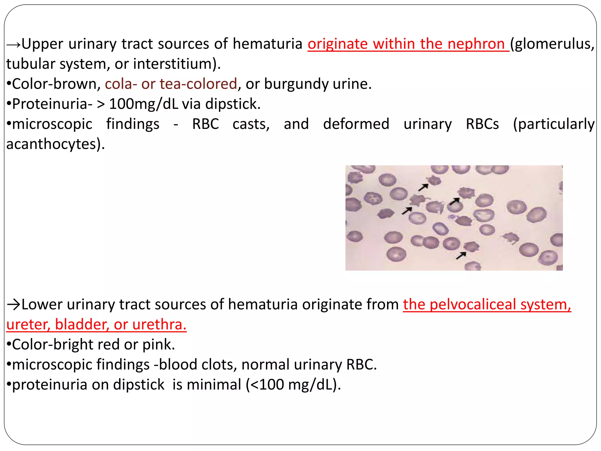 Hematuria.pptx