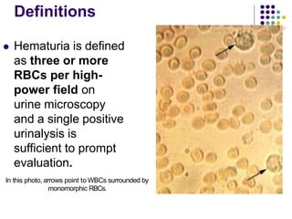 Approach to a patient with hematuria.pptx