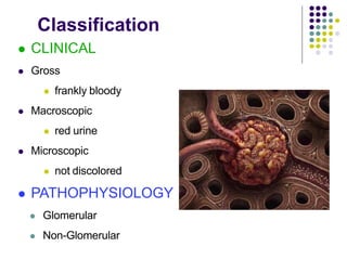 Approach to a patient with hematuria.pptx