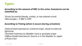 Hematuria for lecture and education .ppt