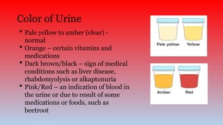 Hematuria - definition, types, risk factors, classification, etiology ...