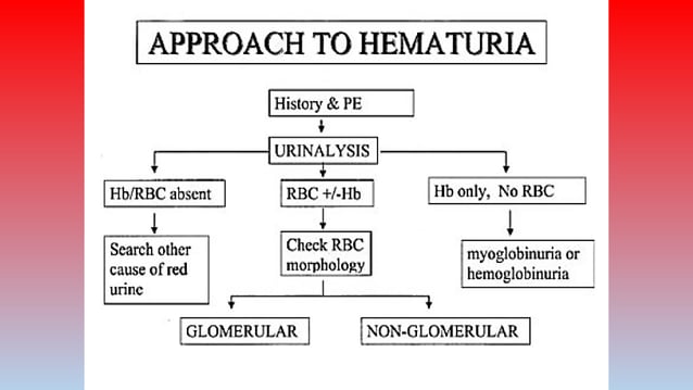 Hematuria - definition, types, risk factors, classification, etiology ...