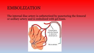 Hematuria - definition, types, risk factors, classification, etiology ...