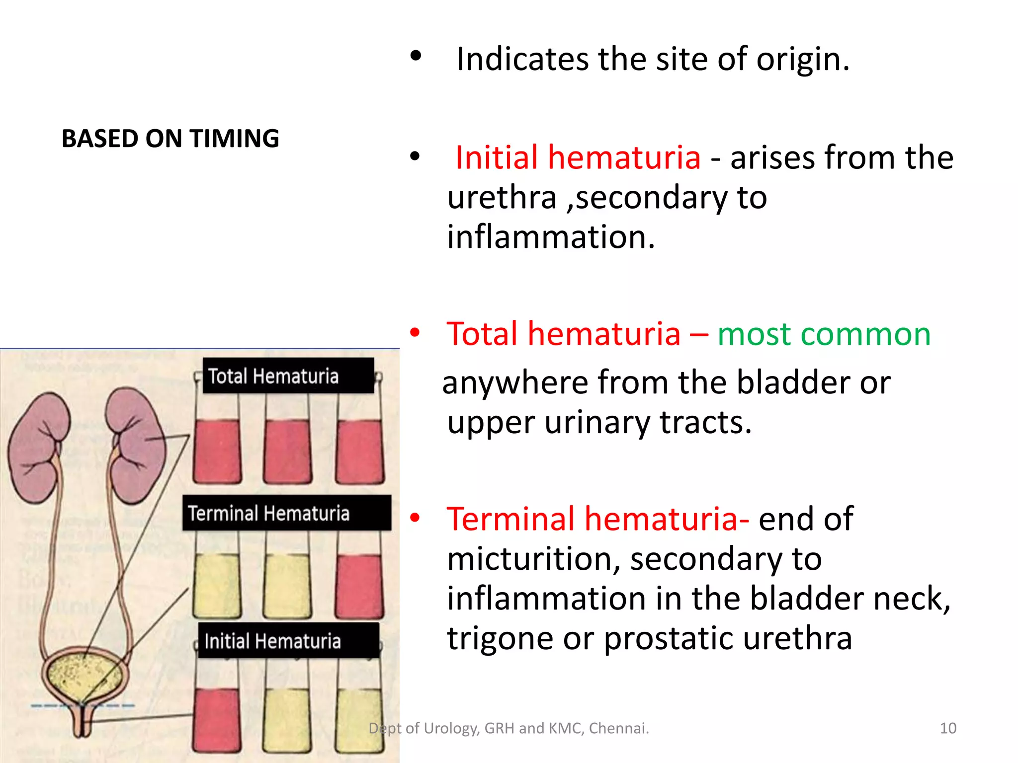 Hematuria - causes and evaluation | PDF