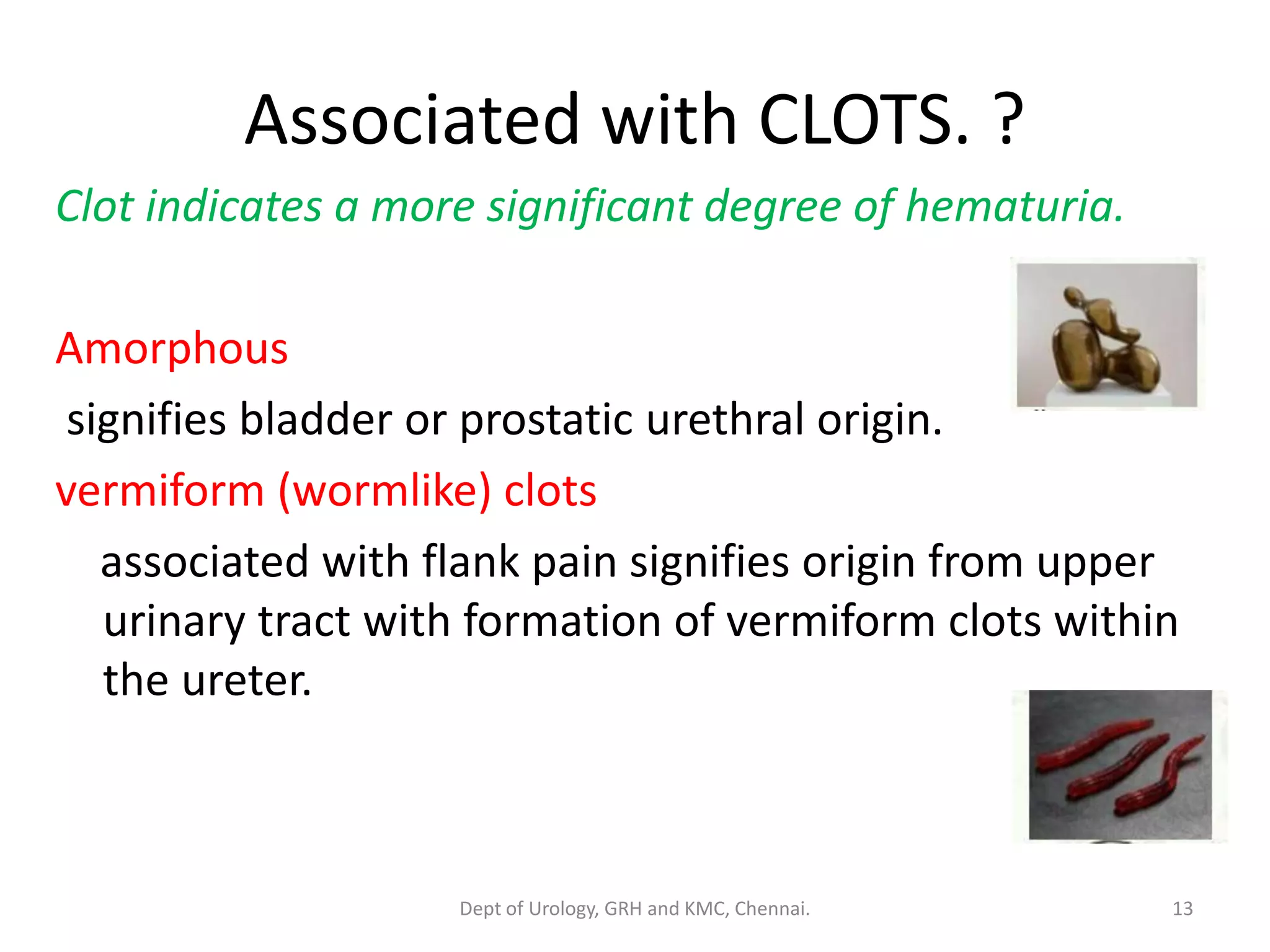 Hematuria - causes and evaluation | PDF