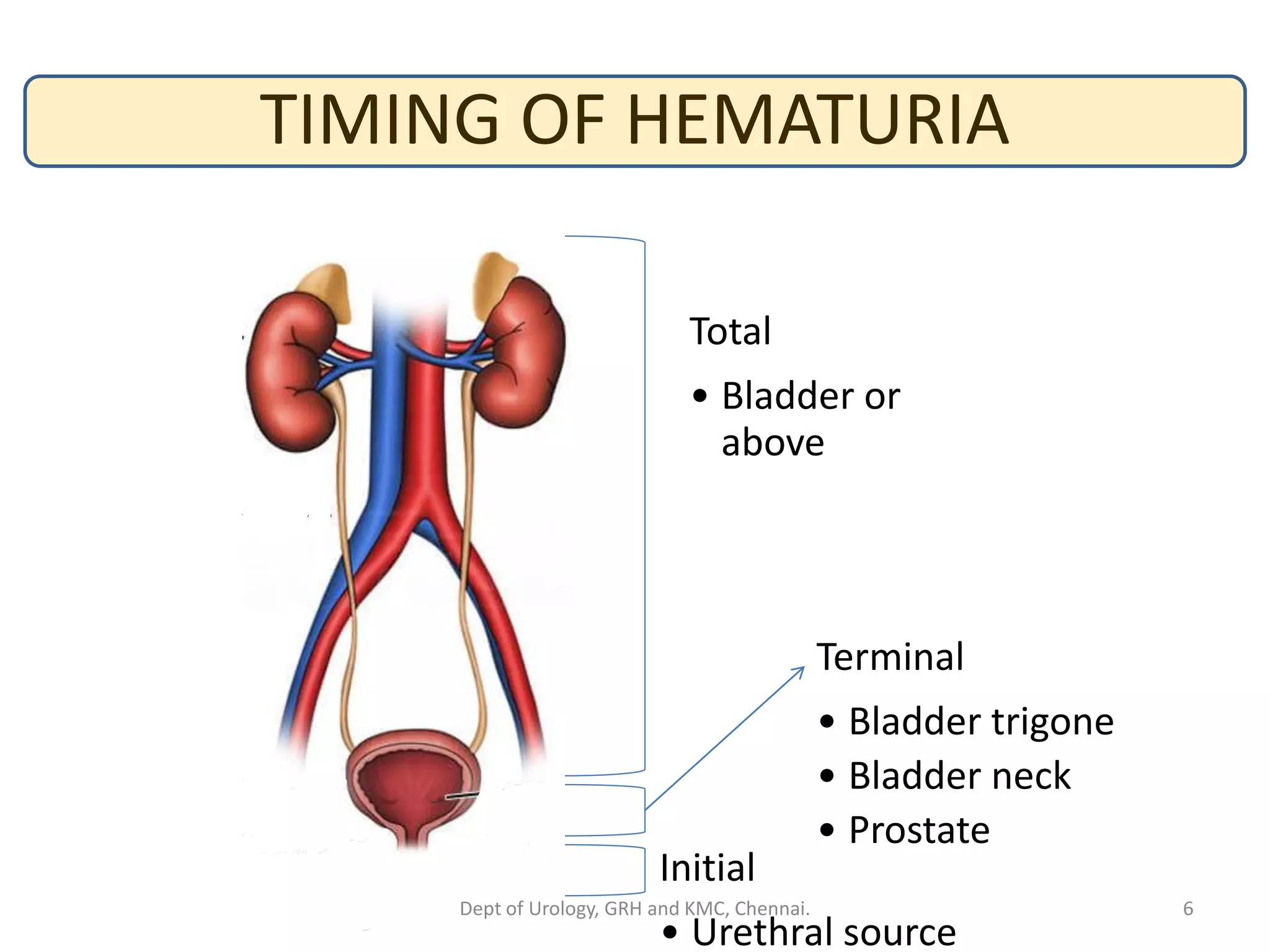 Hematuria - evaluation and management | PDF