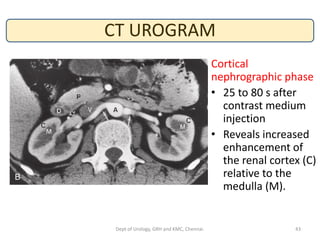 Hematuria - evaluation and management | PDF