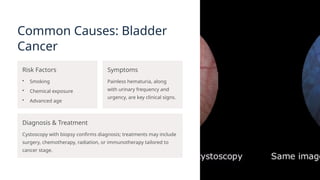Hematuria-Understanding-Blood-in-the-Urine | PPTX