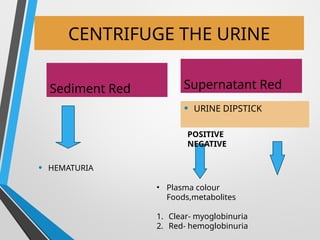 HEMATURIA causes, etiology, management in children | PPTX