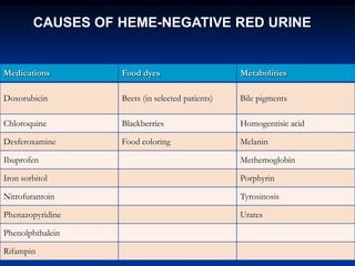 Hematuria | PPSX