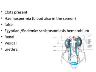 Hematuria | PPT