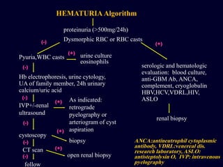Hematuria for undergraduates | PDF