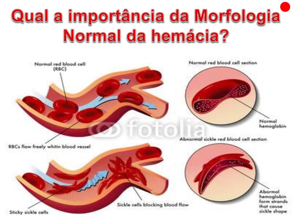 Hemácias Revisão Completa