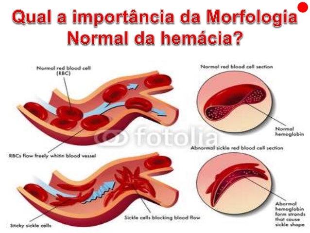 Hemácias Revisão Completa