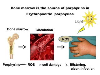 Heme_metabolism and porphyria cutaneous manifestation | PPT