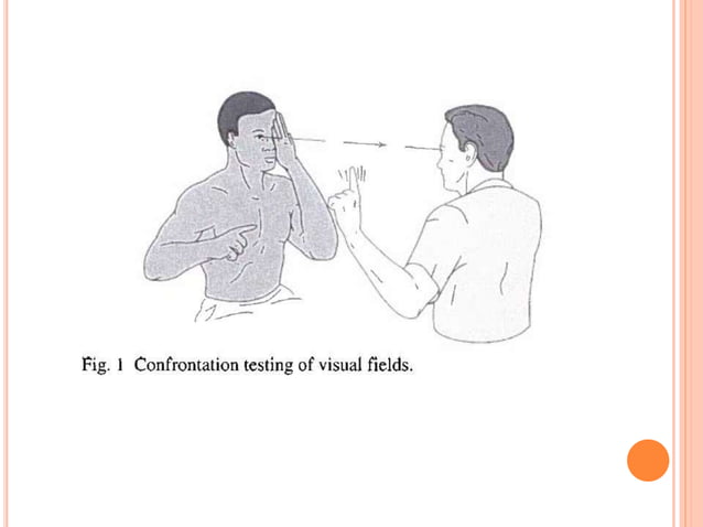 Bitemporal Heteronymous Hemianopia | PPTX | Eye and Vision Conditions ...