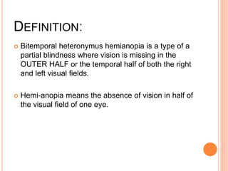 Bitemporal Heteronymous Hemianopia | PPTX