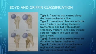 Hemiarthoplasty debate. hemiarthroplasty | PPT