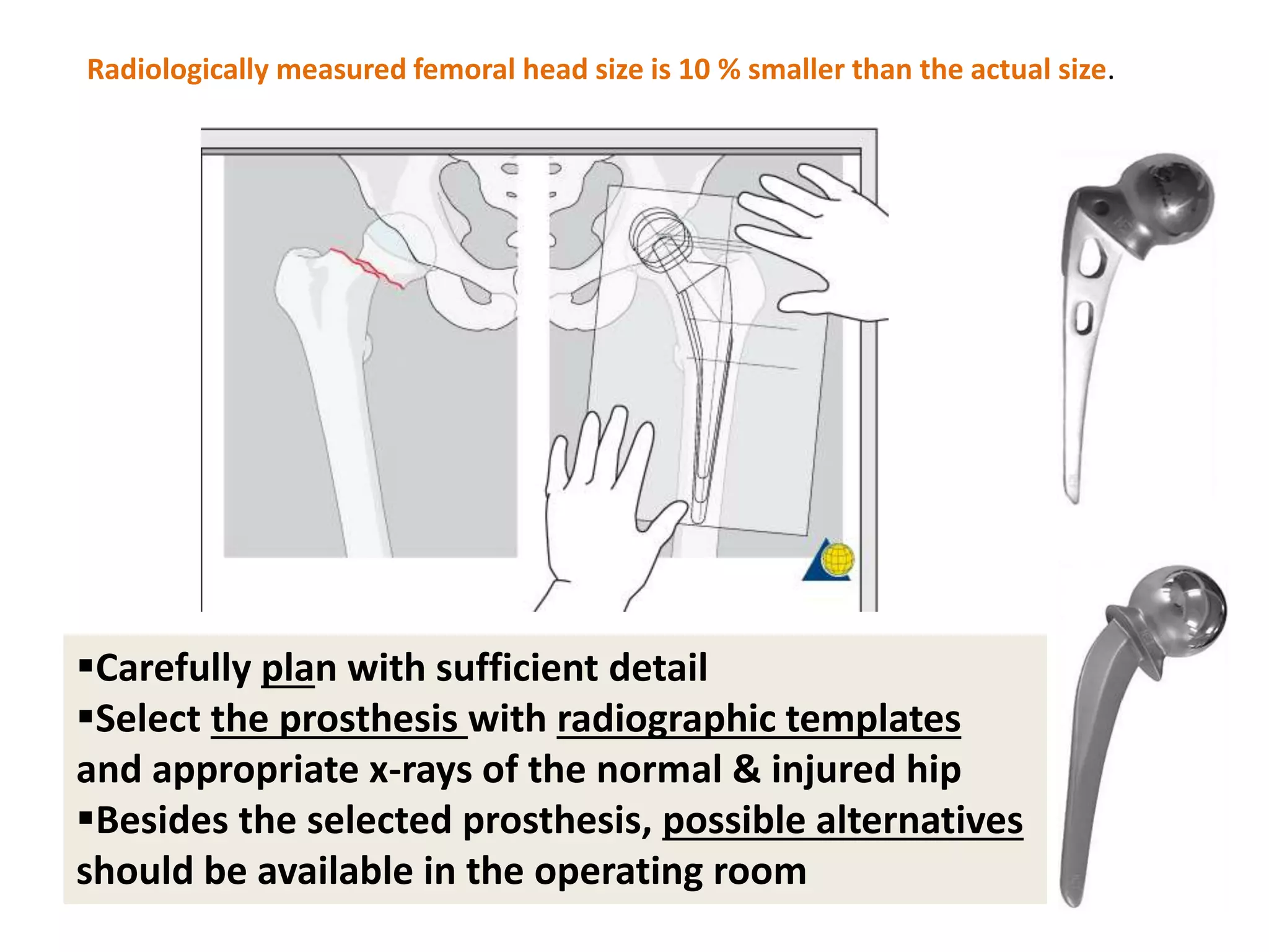 HEMIARTHROPLASTY.pptx