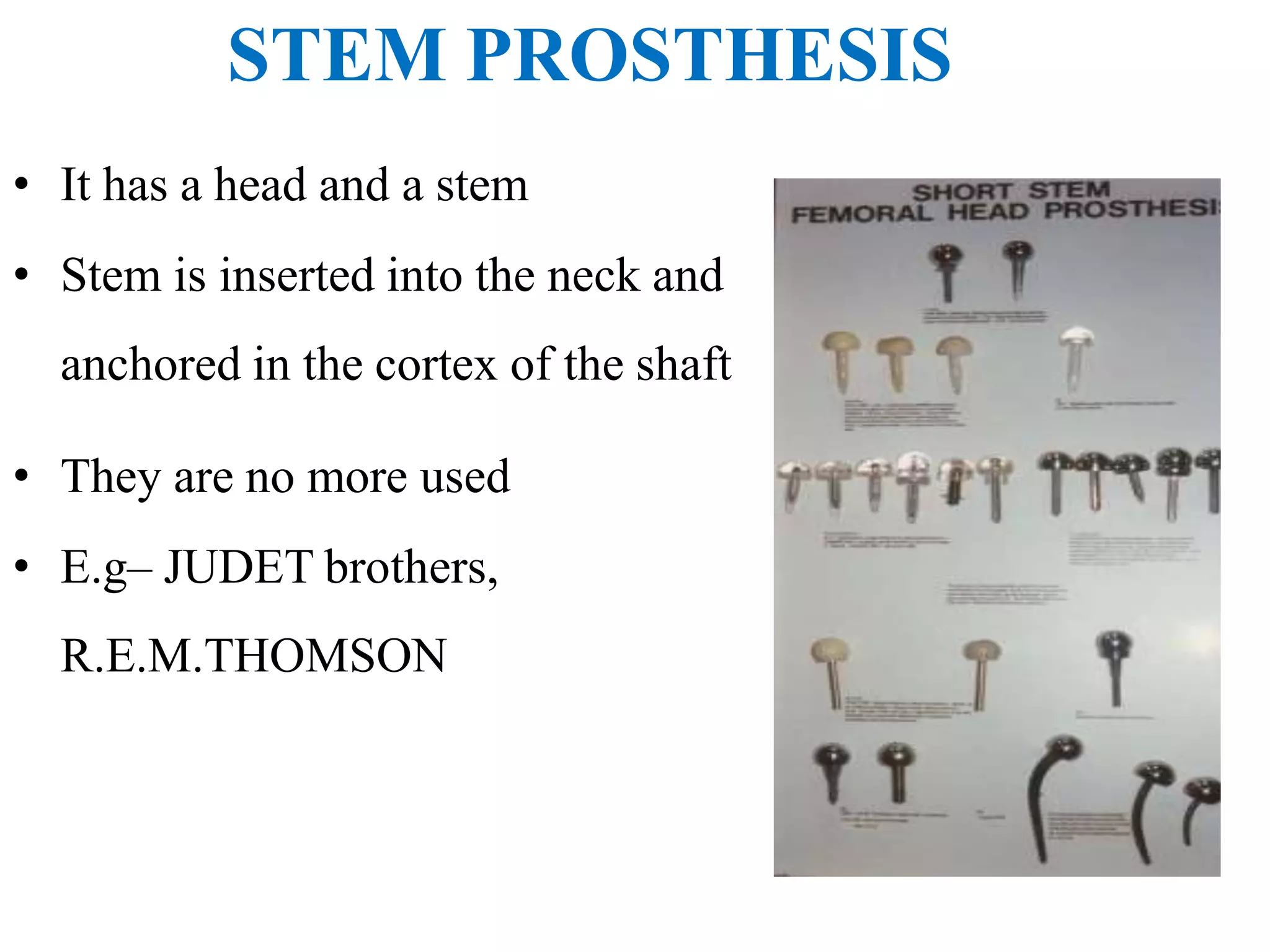 hemiarthroplastyunipolarandbipolarindicationsapproachandprocedure ...