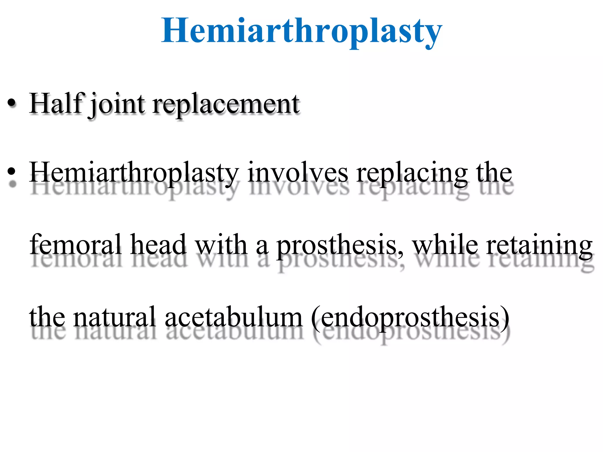 hemiarthroplastyunipolarandbipolarindicationsapproachandprocedure ...
