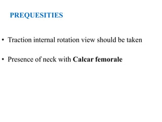 hemiarthroplastyunipolarandbipolarindicationsapproachandprocedure ...