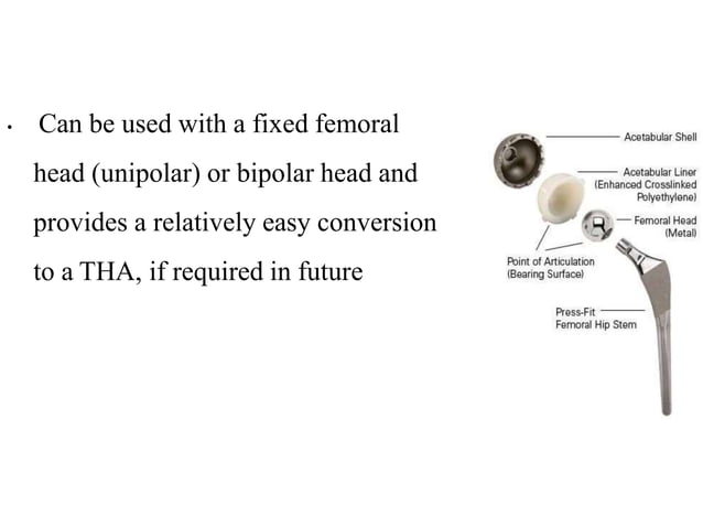 hemiarthroplastyunipolarandbipolarindicationsapproachandprocedure ...