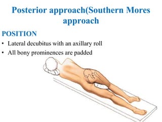 hemiarthroplastyunipolarandbipolarindicationsapproachandprocedure ...