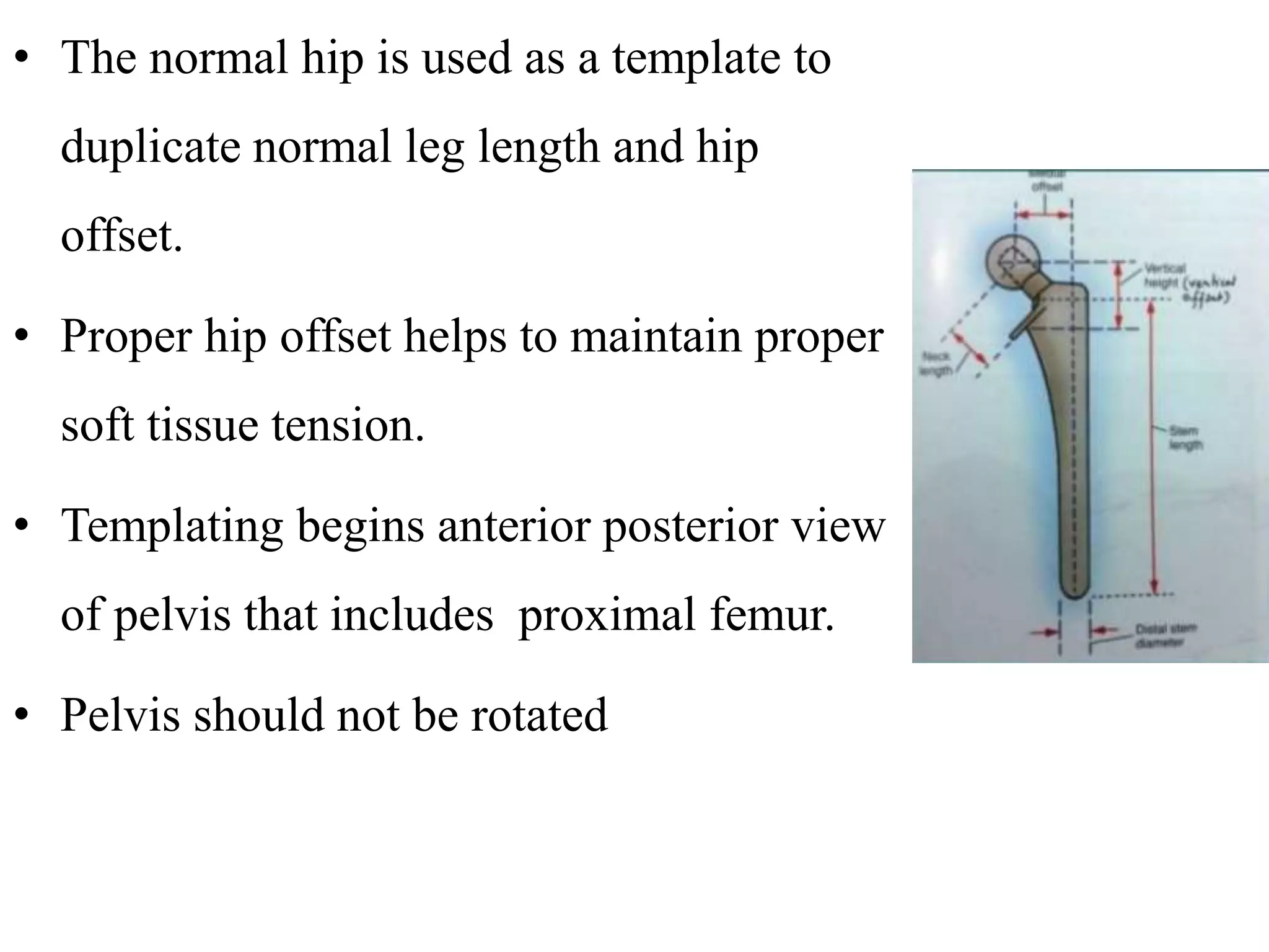 Hemiarthroplasty of Hip joint