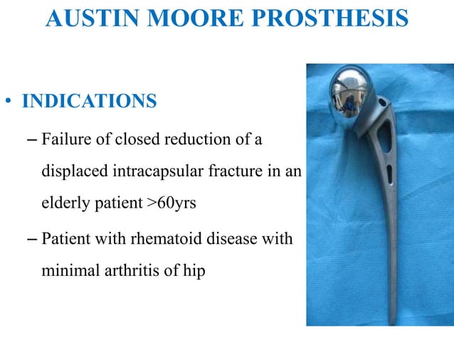 Hemiarthroplasty of Hip joint | PPT