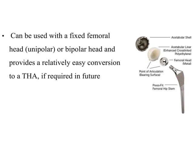 Hemiarthroplasty of Hip joint | PPT