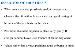 Hemiarthroplasty of Hip joint | PPTX
